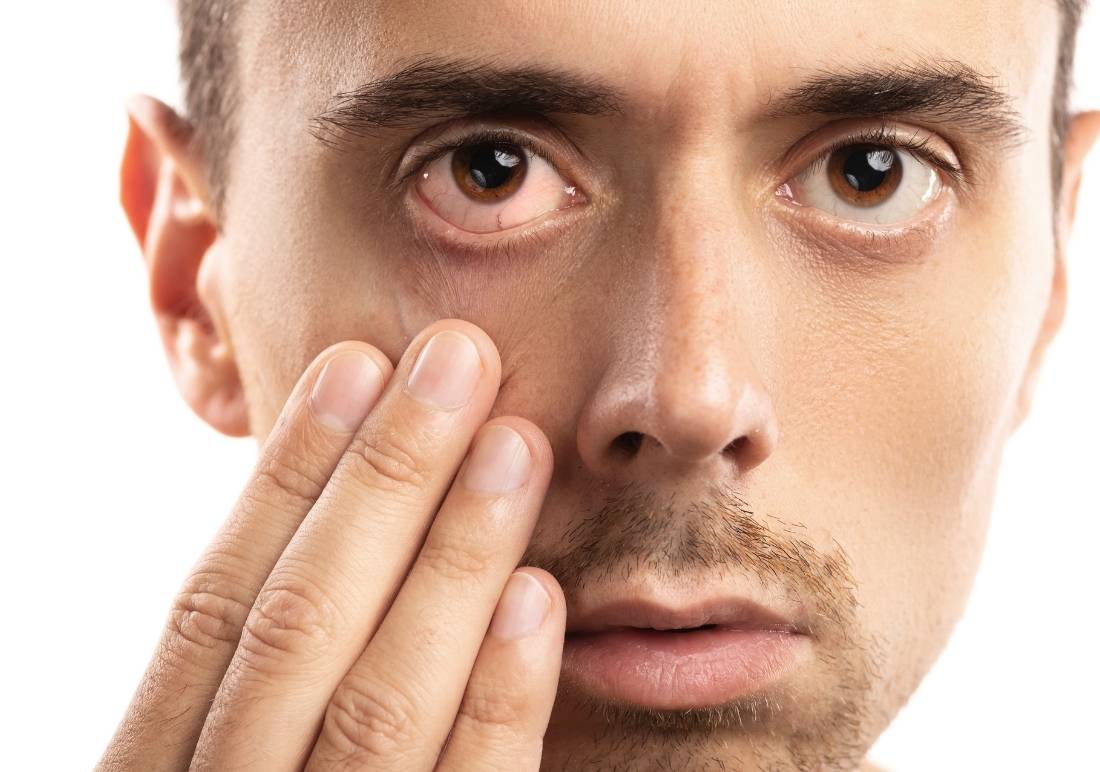 Göz Sağlamlığını Qorumaq üçün Hansı Qidalar və Vitaminlər Faydalıdır?